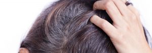 Grey Hair - Canadian Dermatology Association