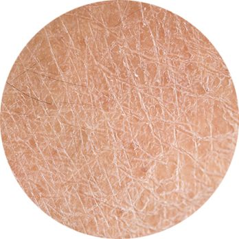 Skin Conditions - Canadian Dermatology Association